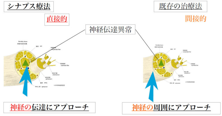 シナプス療法とは - 神経医科学研究所
